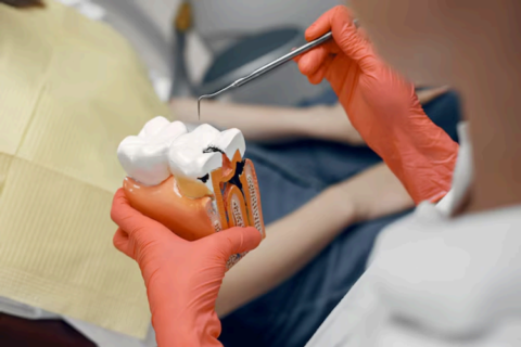 Partial root canal vs Root Canal | Dr. Alisha Khan
